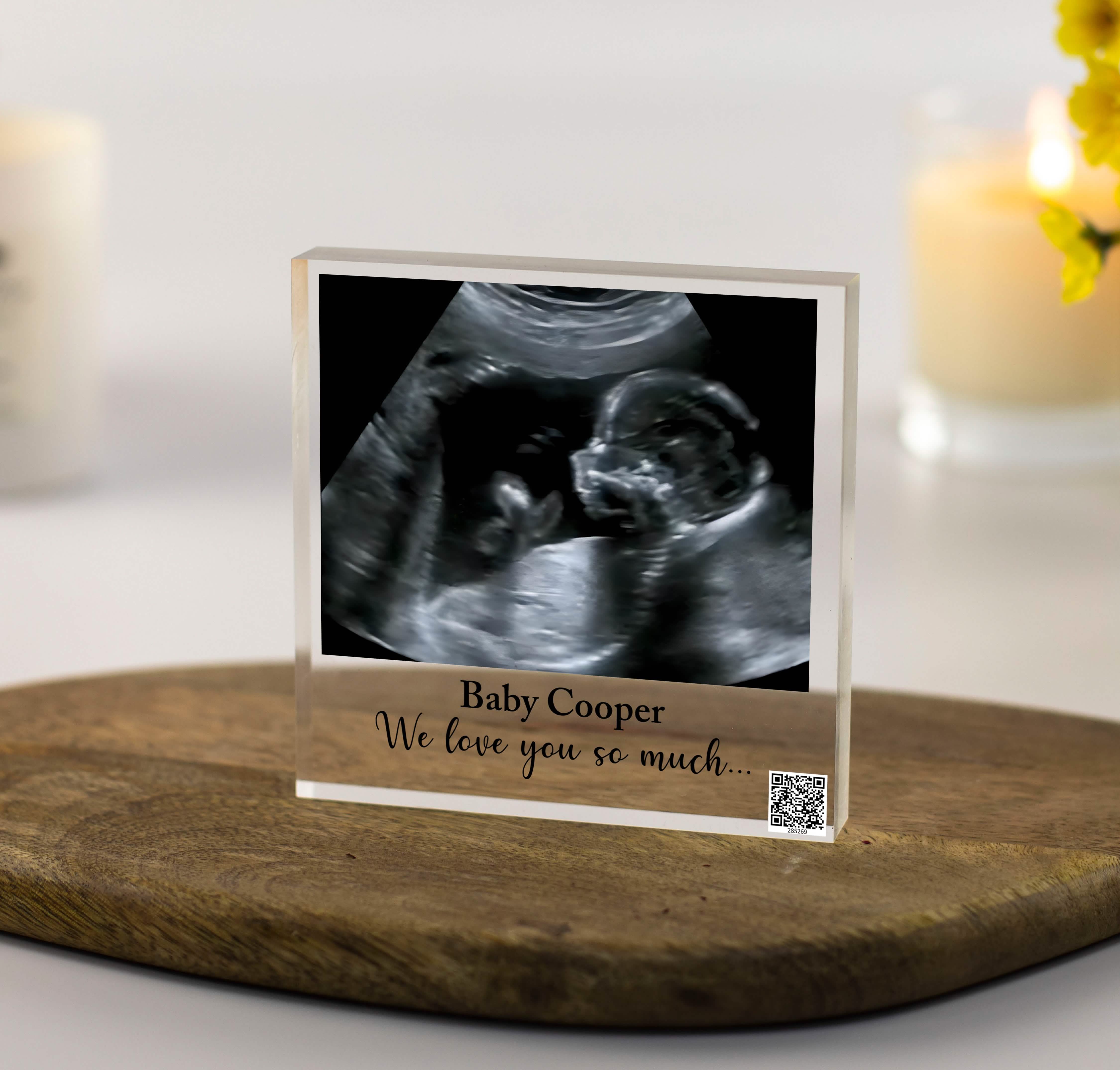 Baby Scan Photo Memory Block – PersonalisedBee